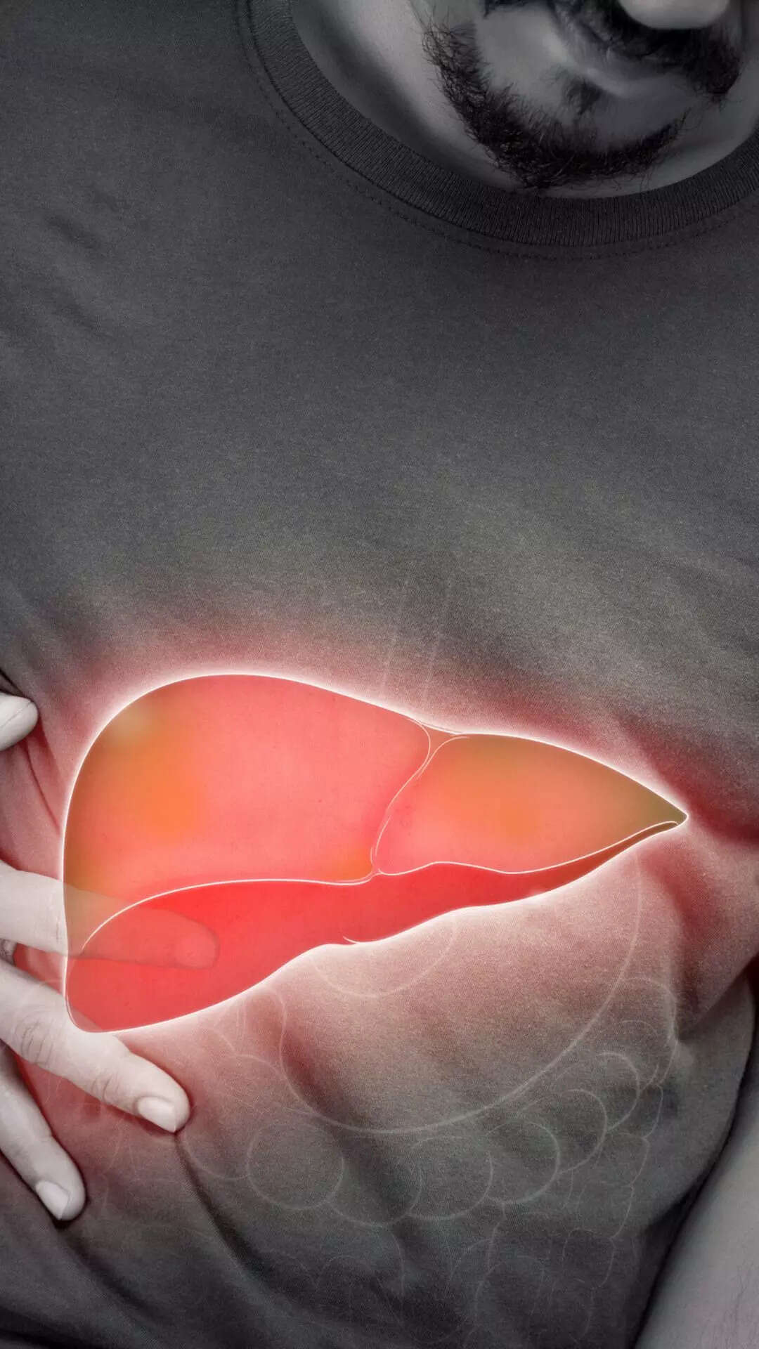 5 visible skin changes signalling liver failure