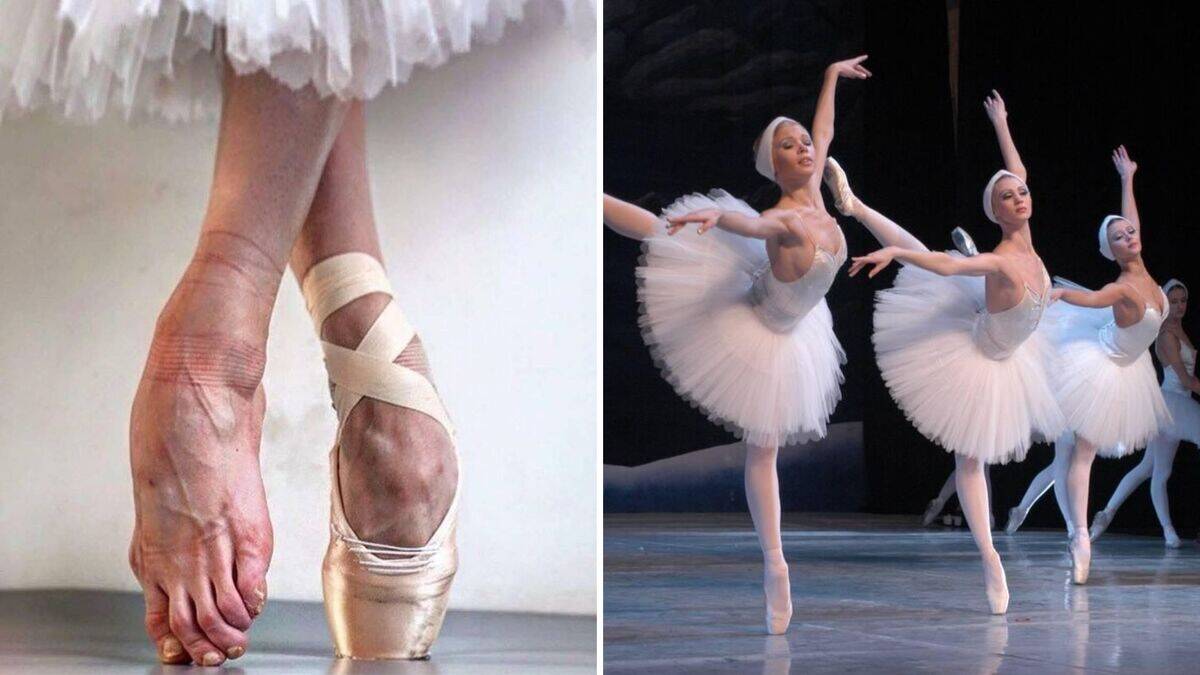 40 Grueling facts about the reality of ballet dancing