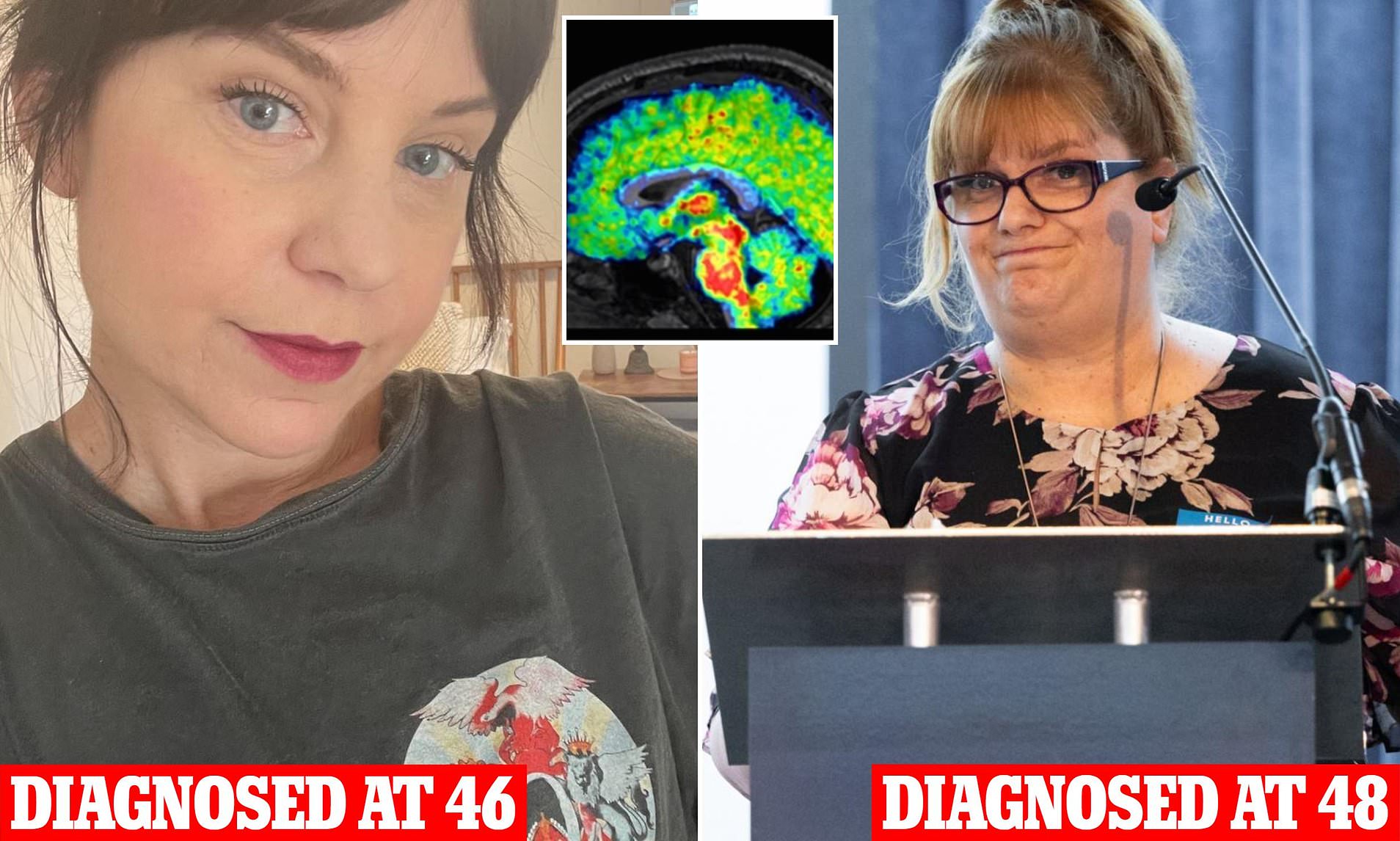 The hidden sign that reveals Alzheimer's disease years before symptoms ...