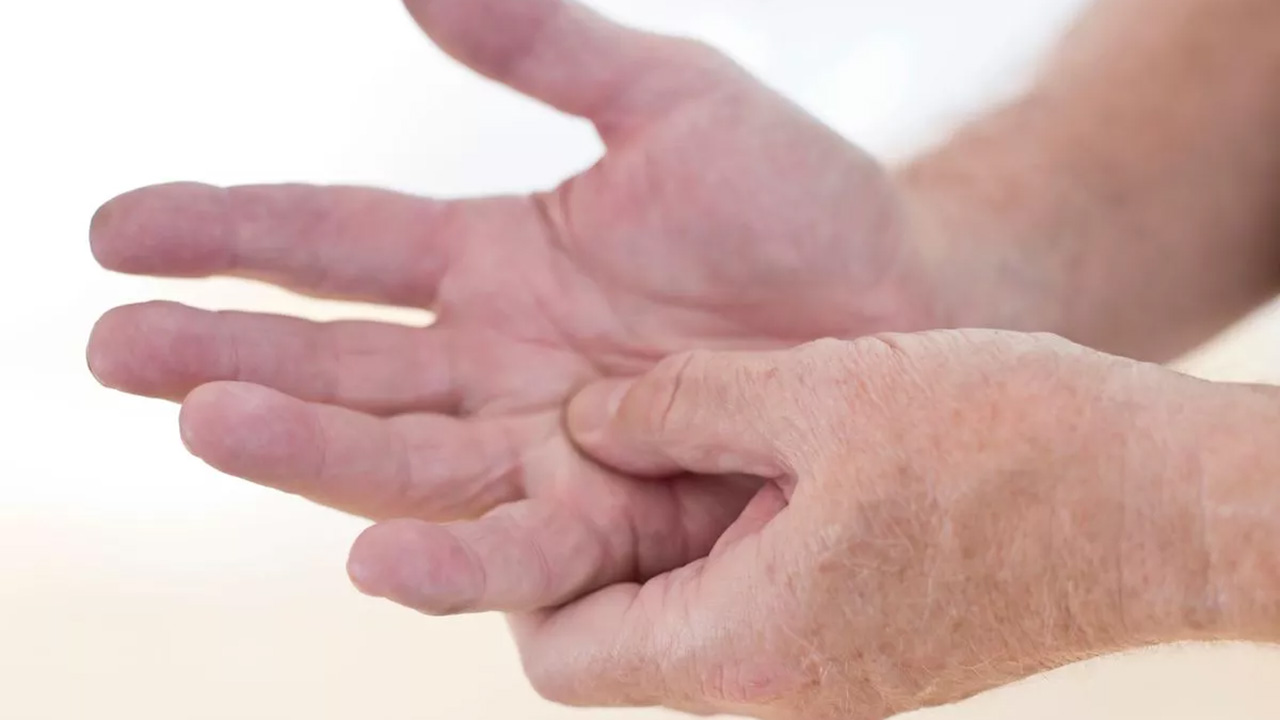 This Subtle Change to Your Hands May Be an Indication of High Cholesterol