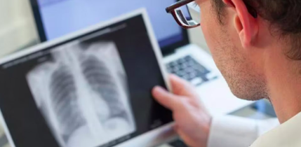 TB a curable disease, need to end stigma: DHSK