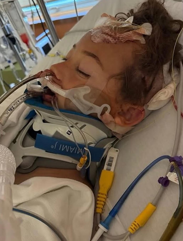 Meet the Putmans Family Car Crash: Gia, 11, Undergoes Skull Surgery