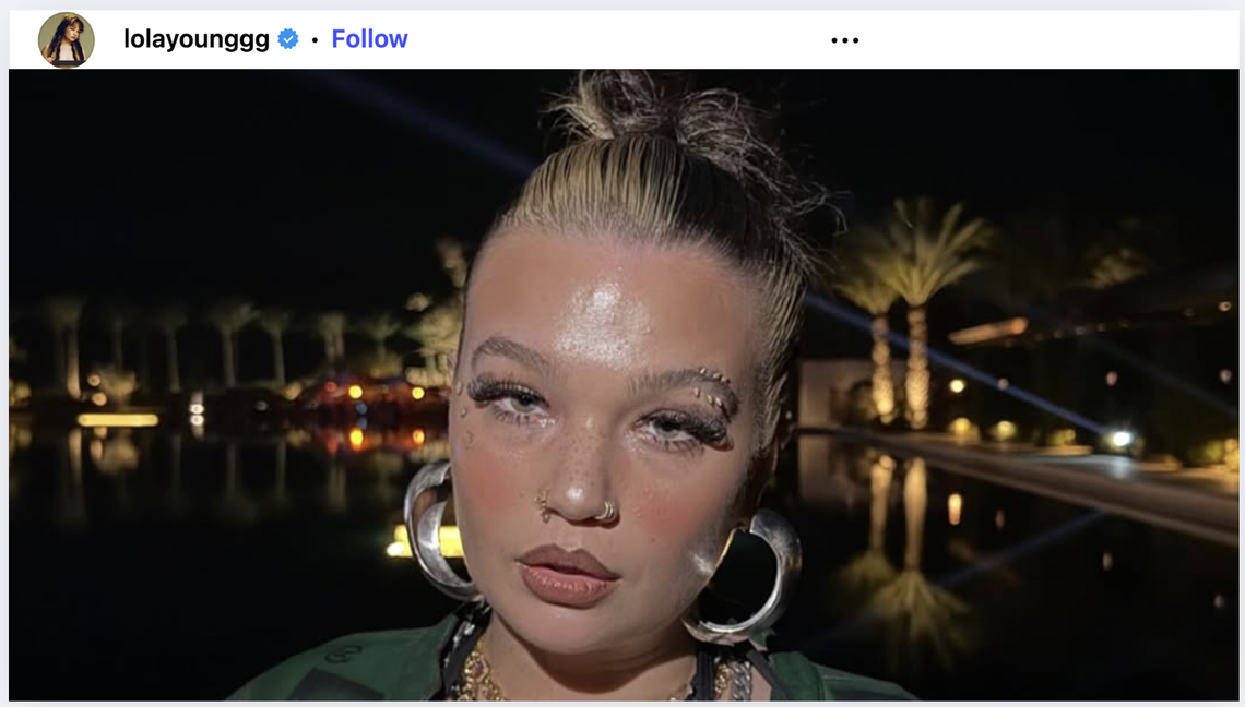 Singer Lola Young speaks out after collapsing on stage: ‘I feel faint'