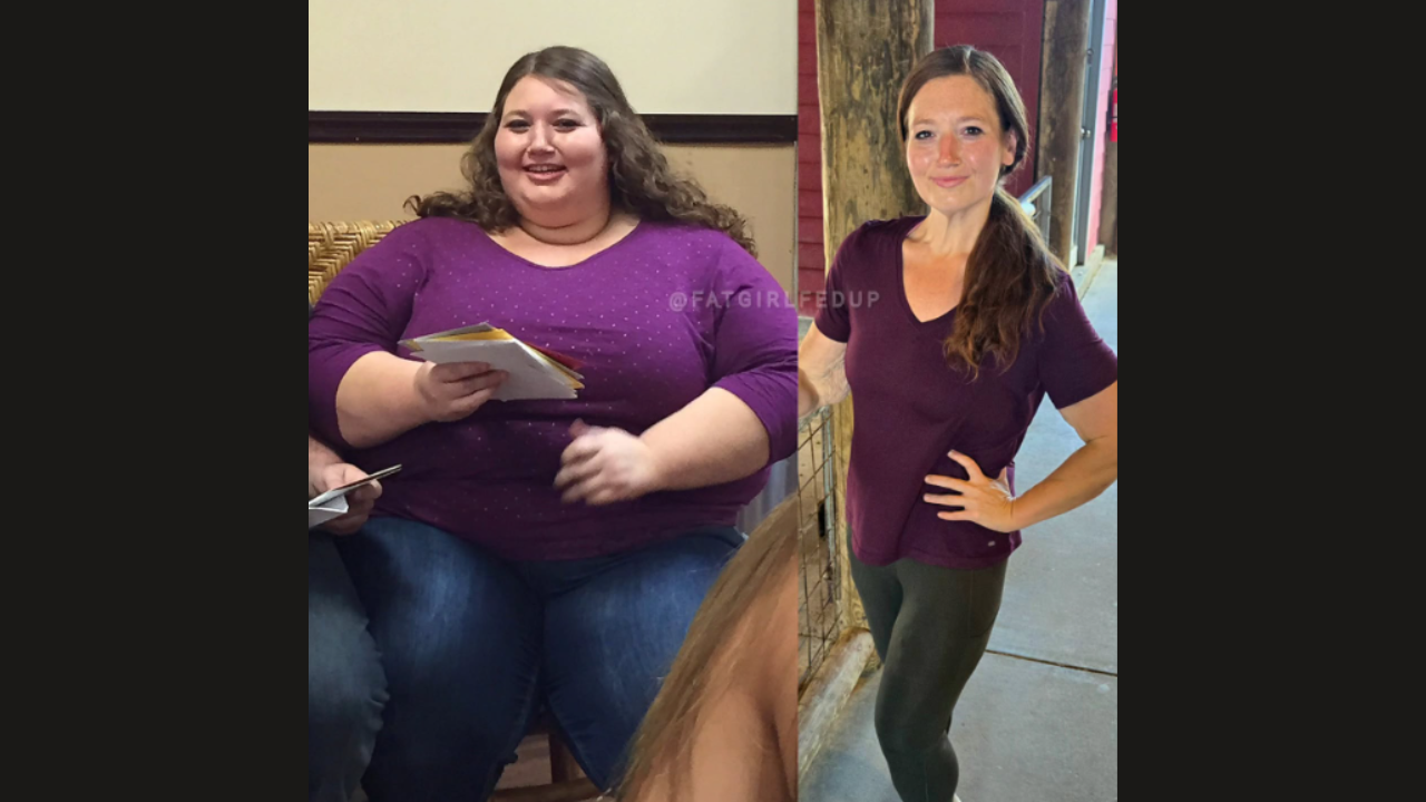 Weight loss story: Woman with rare disease, Calciphylaxis, sheds over ...