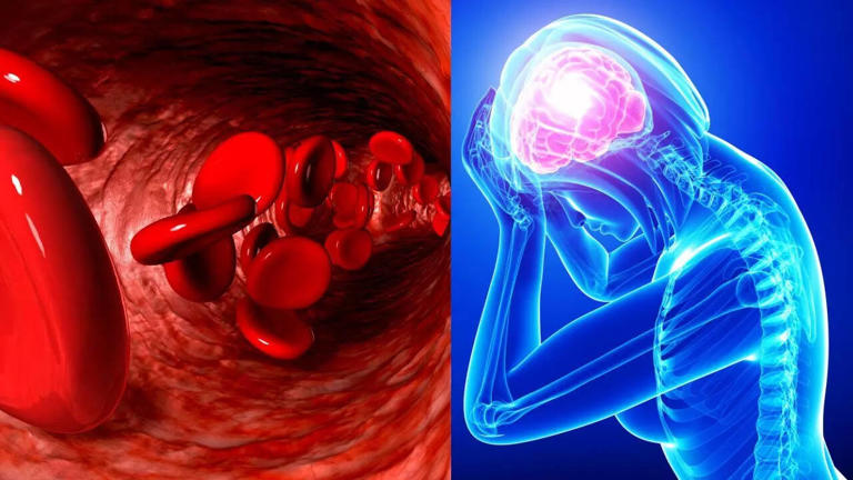 Feel dizzy standing up? Your brain is probably lacking something so ...