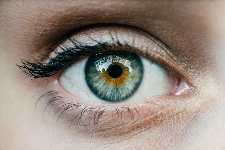 Something in your eye? Read this before trying to get it out yourself.