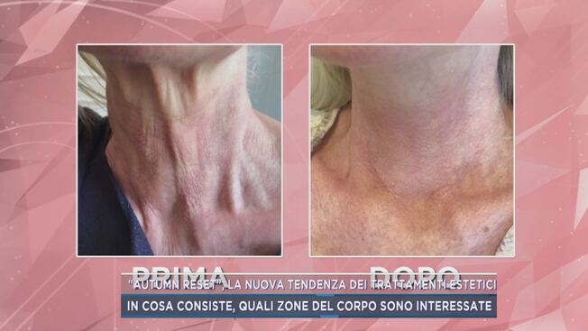 "Autumn Reset", la nuova tendenza dei trattamenti estetici