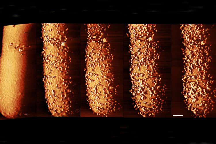 Extraordinary pictures show what a common antibiotic does to E. coli