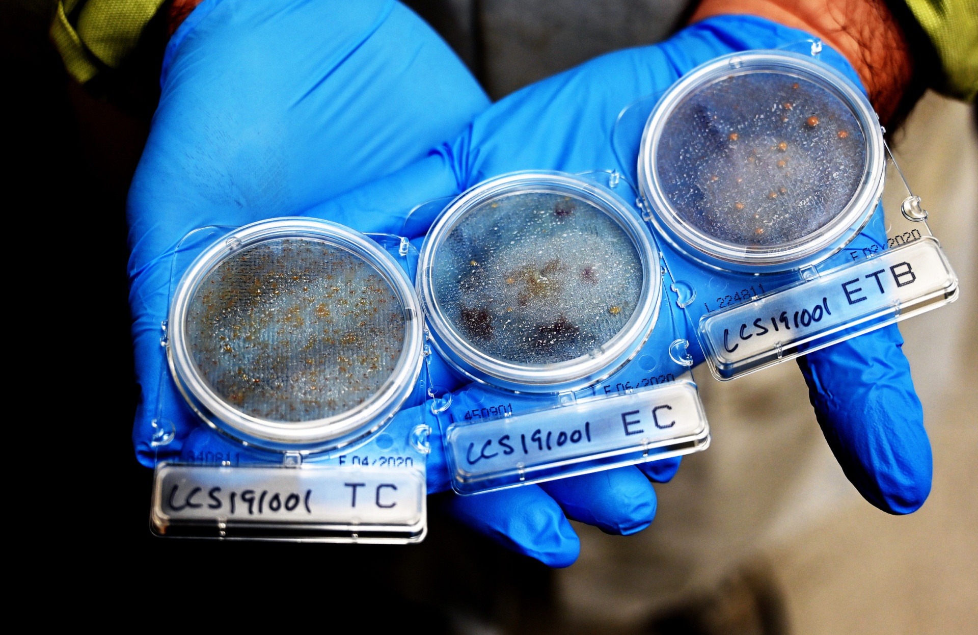 ‘Body-eating’ fungus could spread as Earth heats up