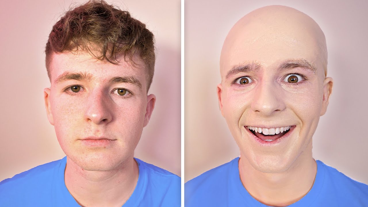My family's reaction when I went bald