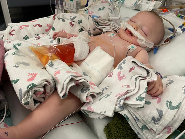 My baby nearly died after swallowing a water bead. It inspired me to ...