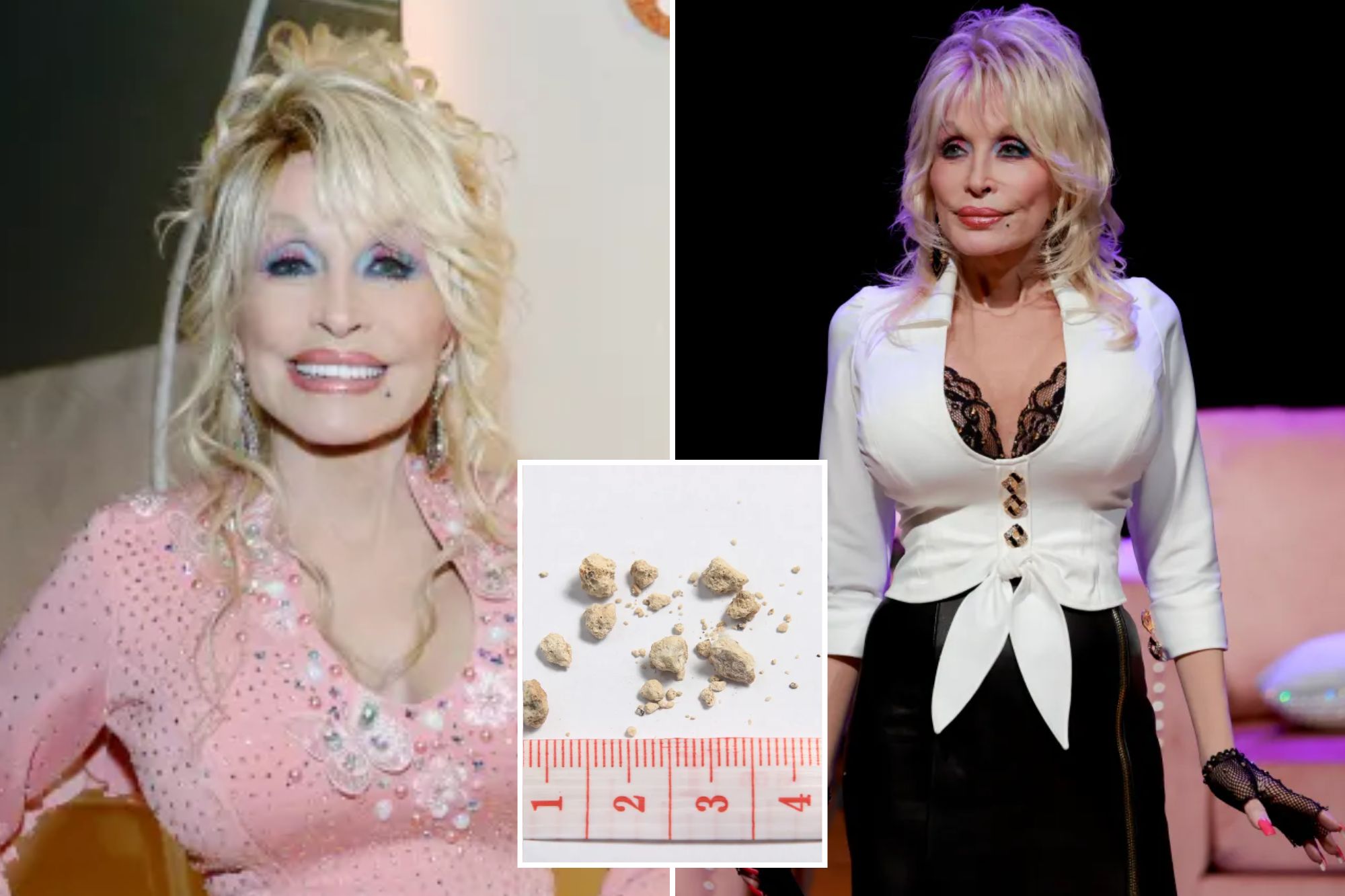 What To Know About Dolly Partons Health Challenges As Legends Sister