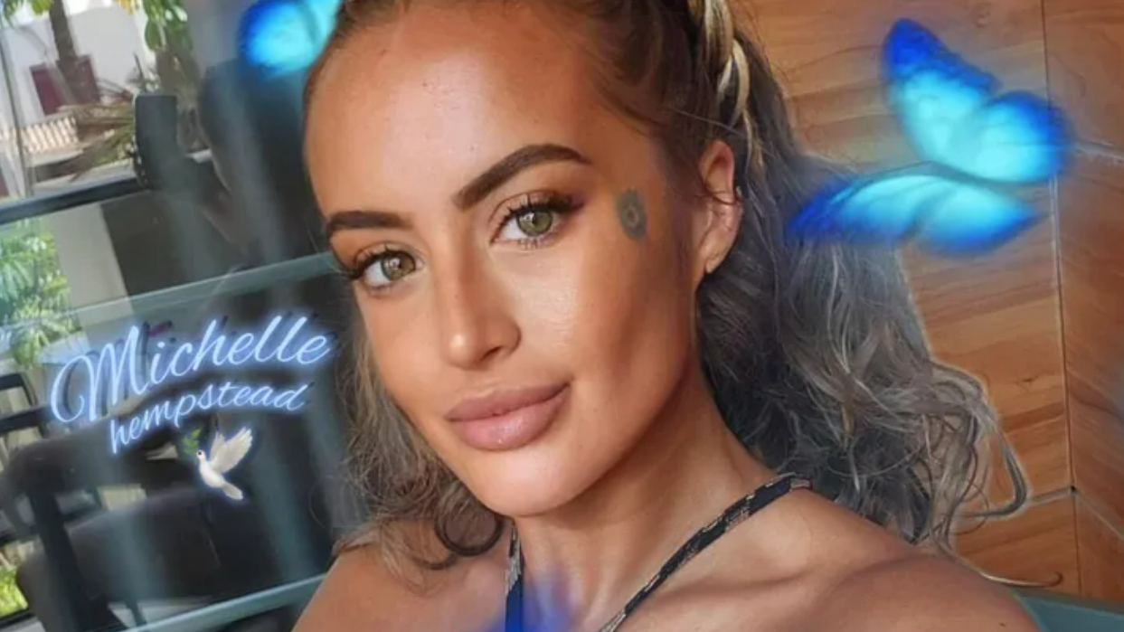 Woman died after intervening in dogs' nugget fight