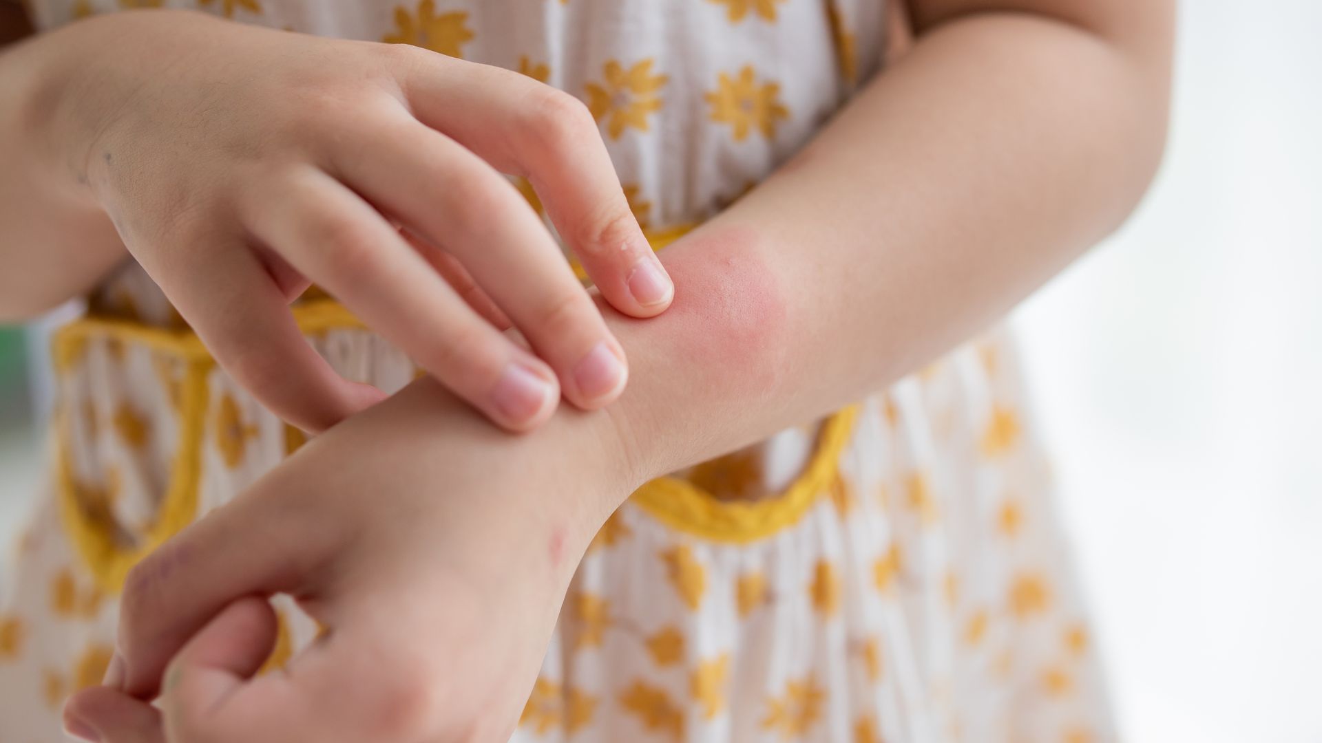 4 situaciones en que debes llevar a tu hijo a Urgencias por una ...