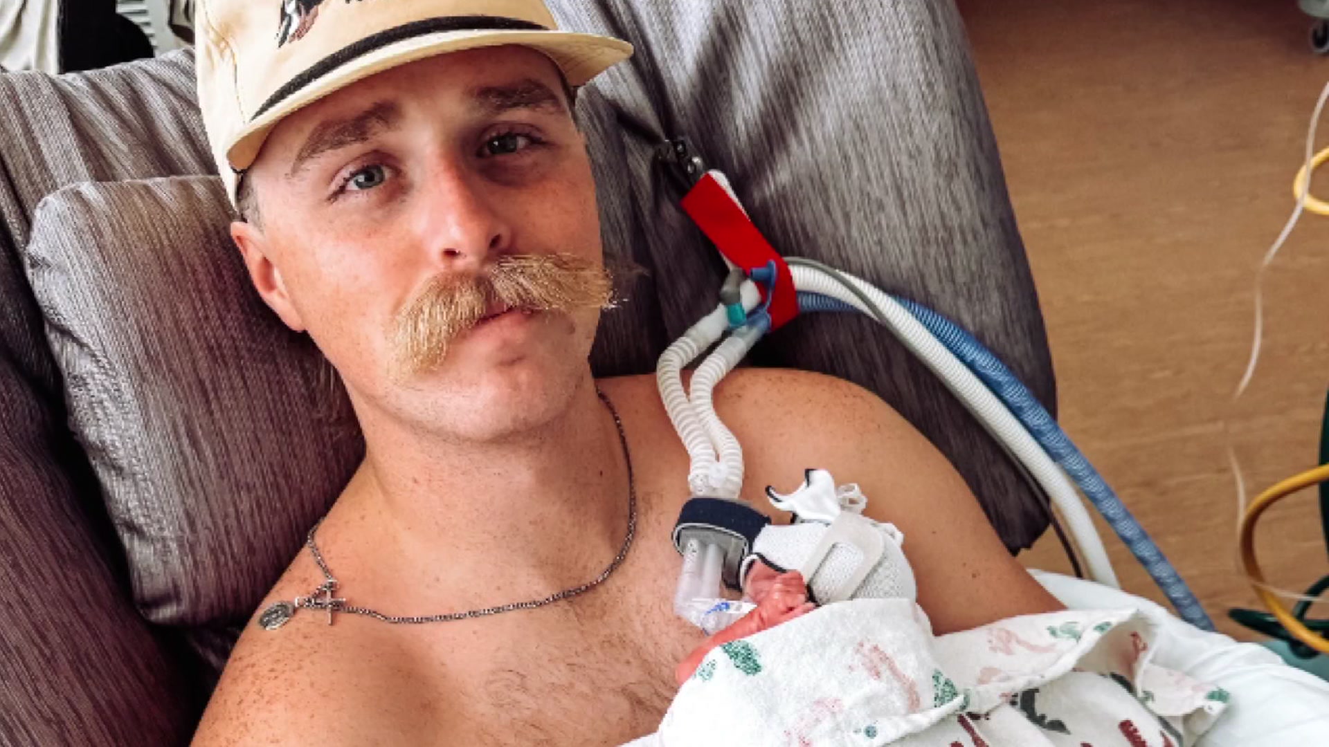 Family gives update on Fort Worth firefighter recovering from burns ...