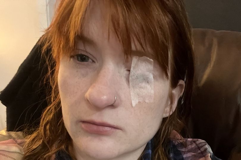 'My face became paralysed after drinking tea – now I have to tape eyes ...