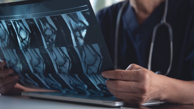 Scientists discover surprising link between bone health and where ...