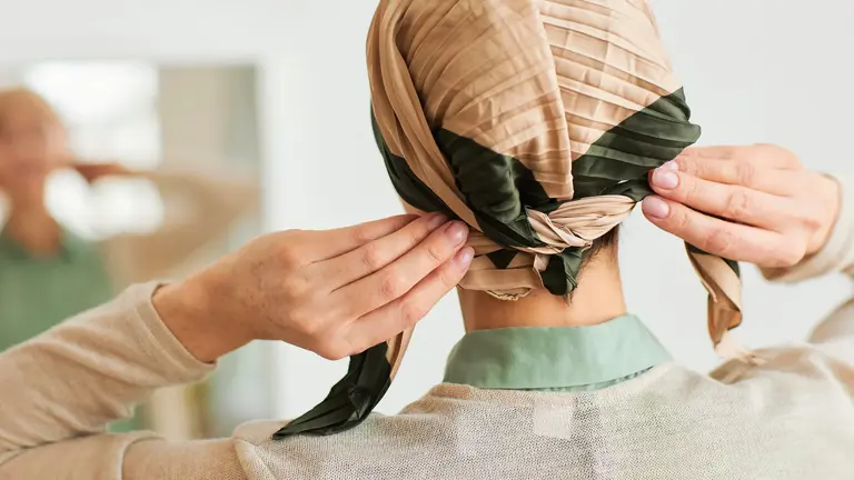 How to Cope With Hair Loss From Alopecia Areata