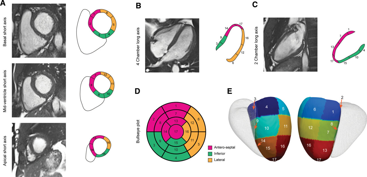 First 3D genetic mapping of the heart uncovers genes implicated in ...