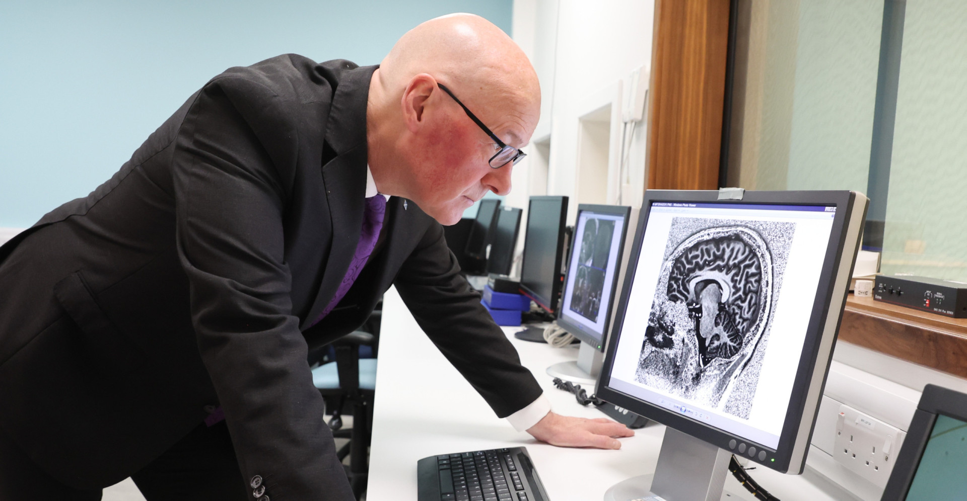 Why the human brain has shrunk