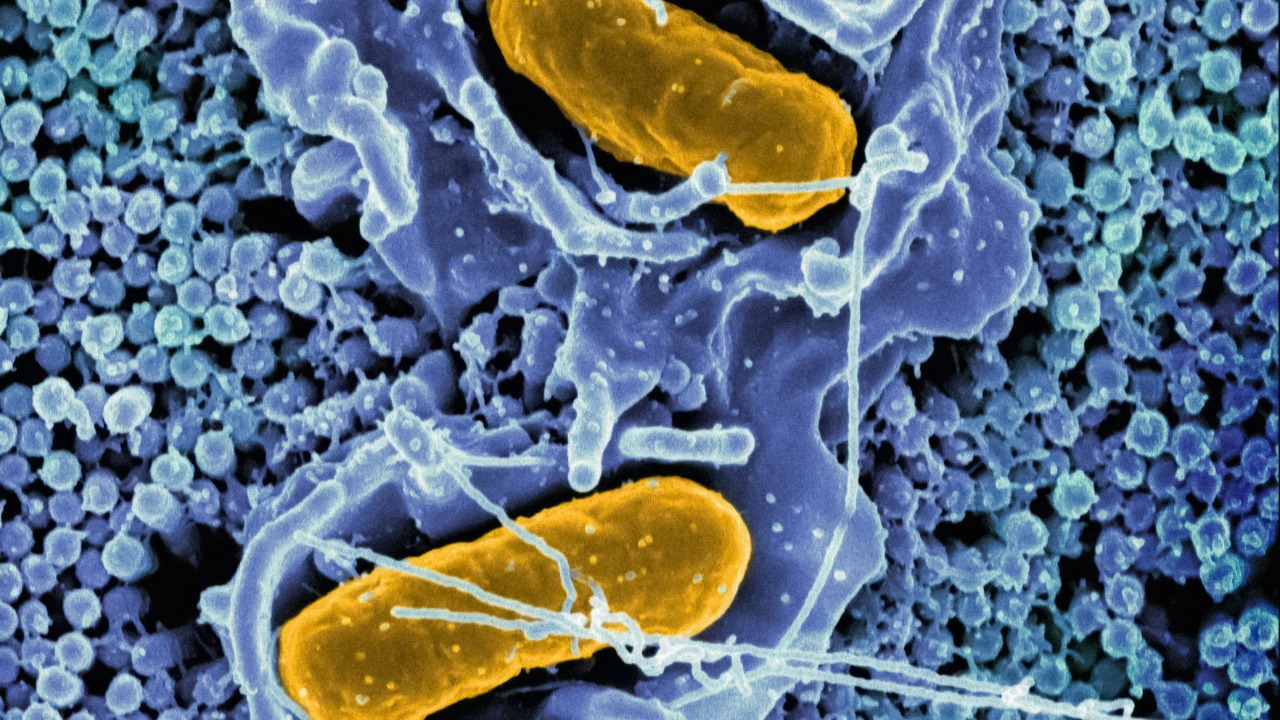 New material kills bacteria with microscopic knives