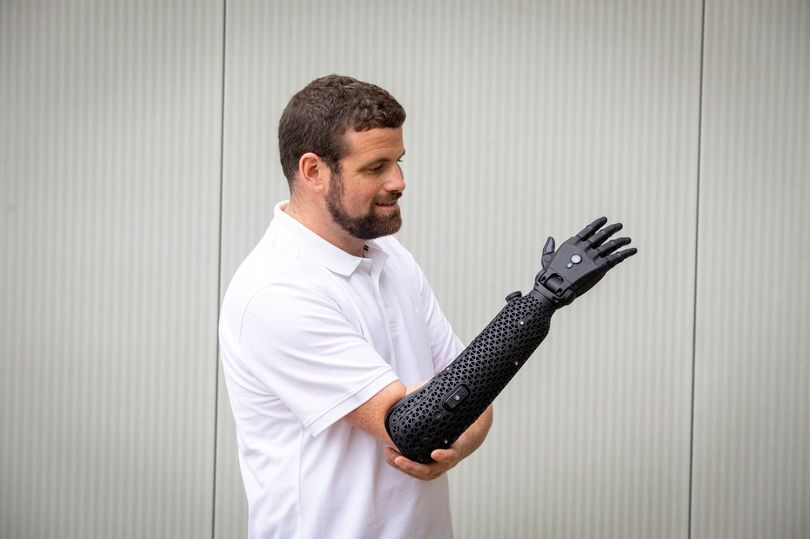Farmer who lost arm in harvester gets new NHS bionic limb to finally ...