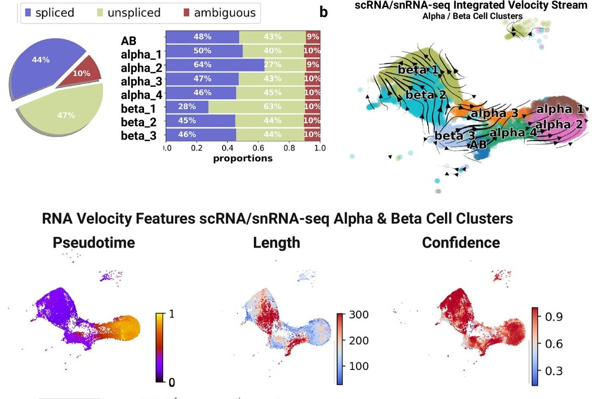 Gene linked to beta cell identity loss may explain type 2 diabetes ...