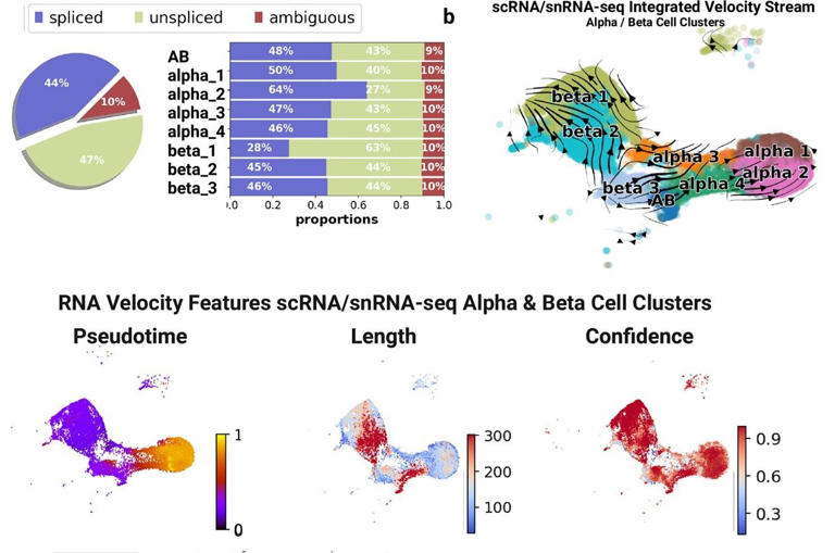 Gene linked to beta cell identity loss may explain type 2 diabetes ...