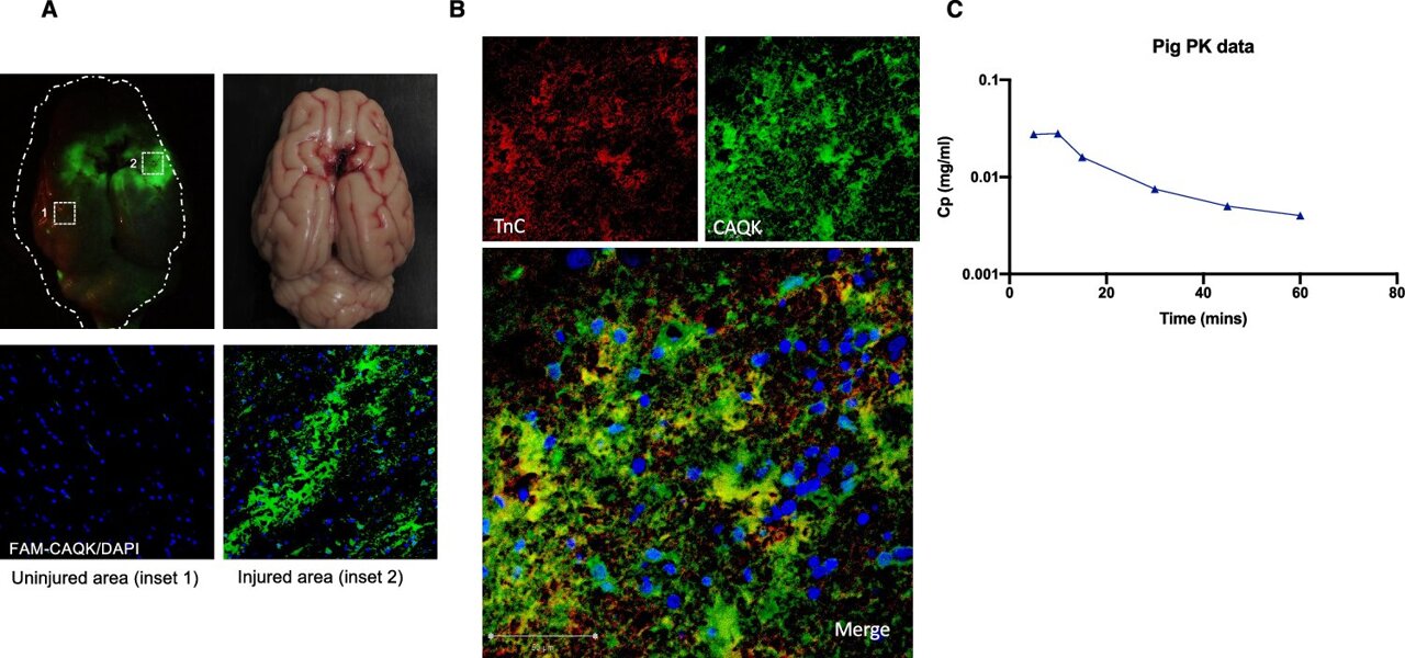 Peptide shows neuroprotective effects in traumatic brain injury