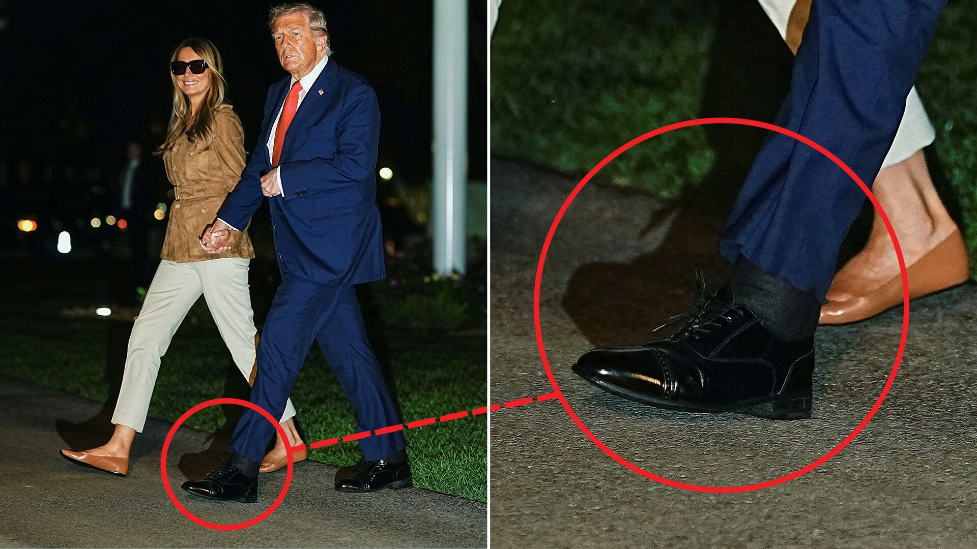 Trump, 79, Reveals Bulging Cankles While Hosting World Leader