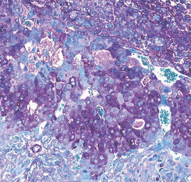 Study reveals ‘good’ bacteria boosts placenta for healthier pregnancies