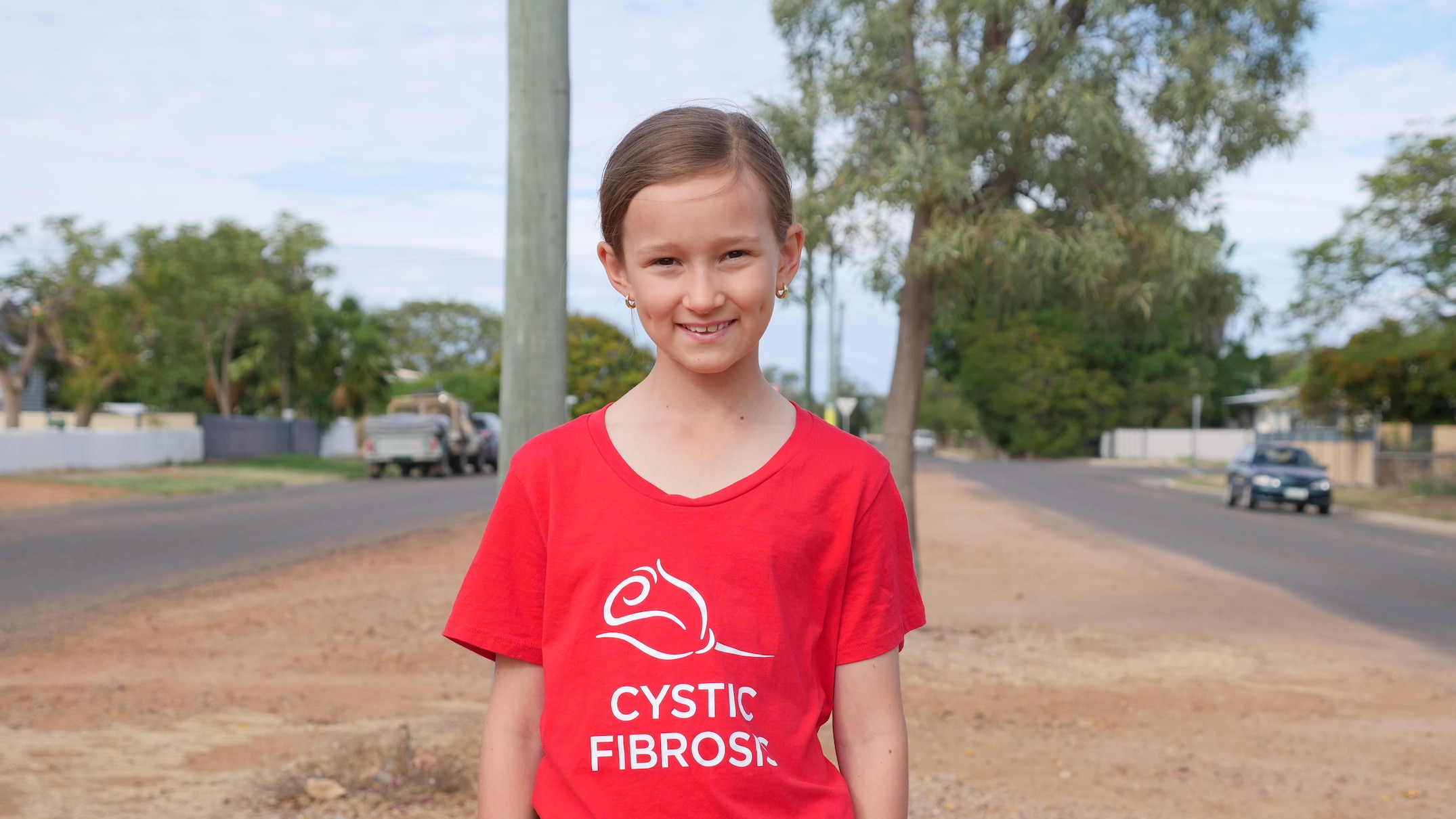 More families raising children with cystic fibrosis staying in the bush