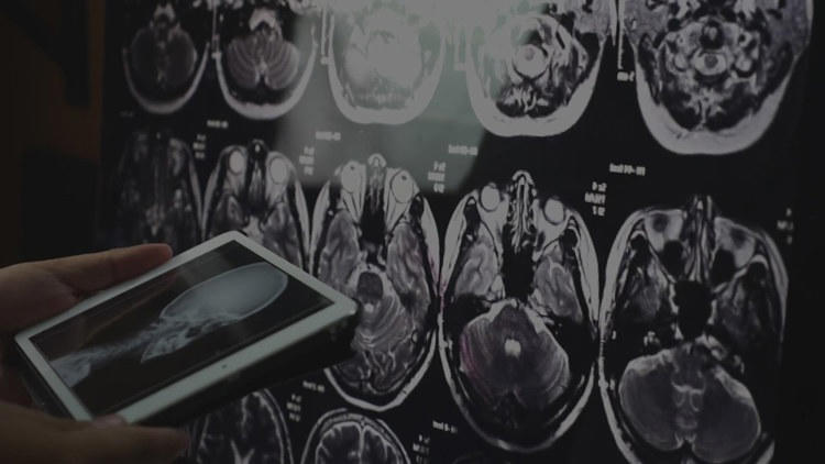 Want to slow aging in your brain? A new study finds lifestyle changes ...