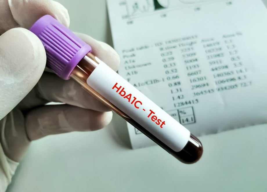 Health: Why is the HbA1c test done? Who is it necessary for? Learn ...