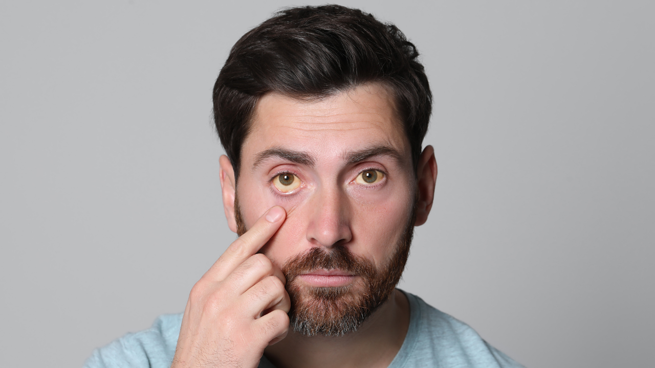 6 common skin problems that indicate a sluggish liver and require ...