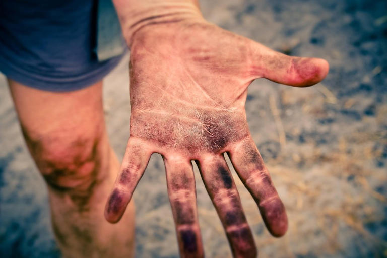 Here’s What Happens If You Ever Step Into Molten Lava