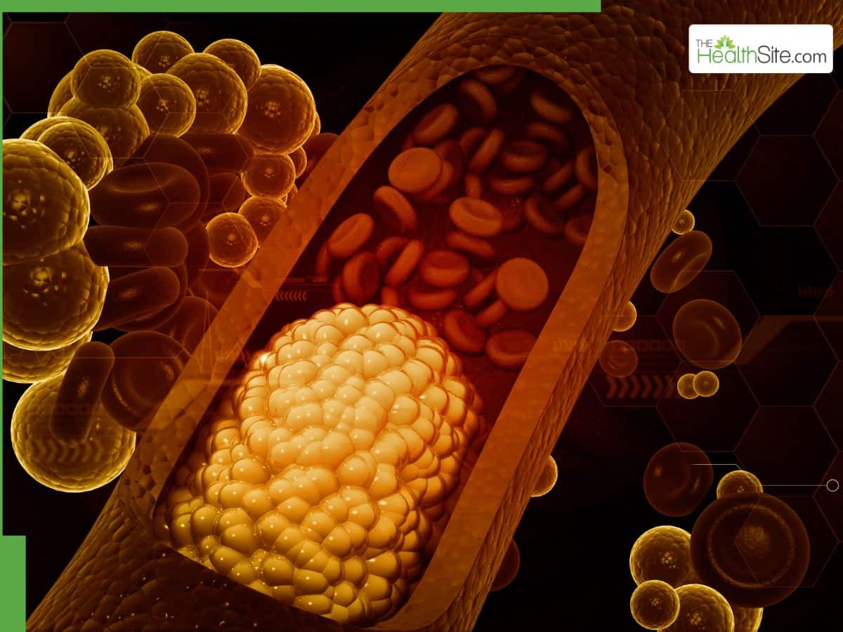 High cholesterol lowering tips: 6 simple exercises to flush out bad ...