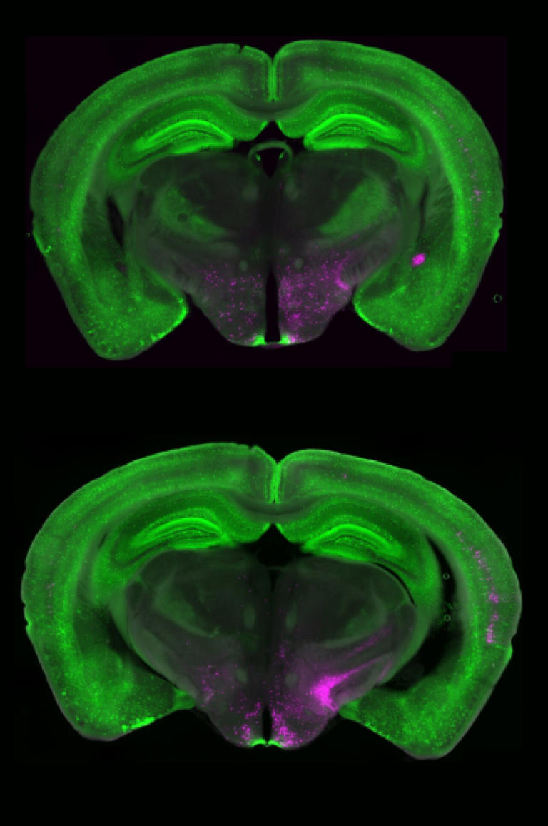 It's all in your head: Select neurons in the brainstem may hold the key ...