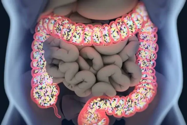 Lo que debe comer para fortalecer la microbiota intestinal: el secreto ...