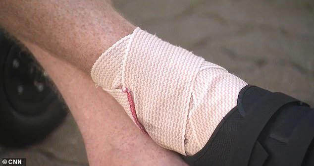 Brit marathon swimmer survives double shark attack by fighting off ...