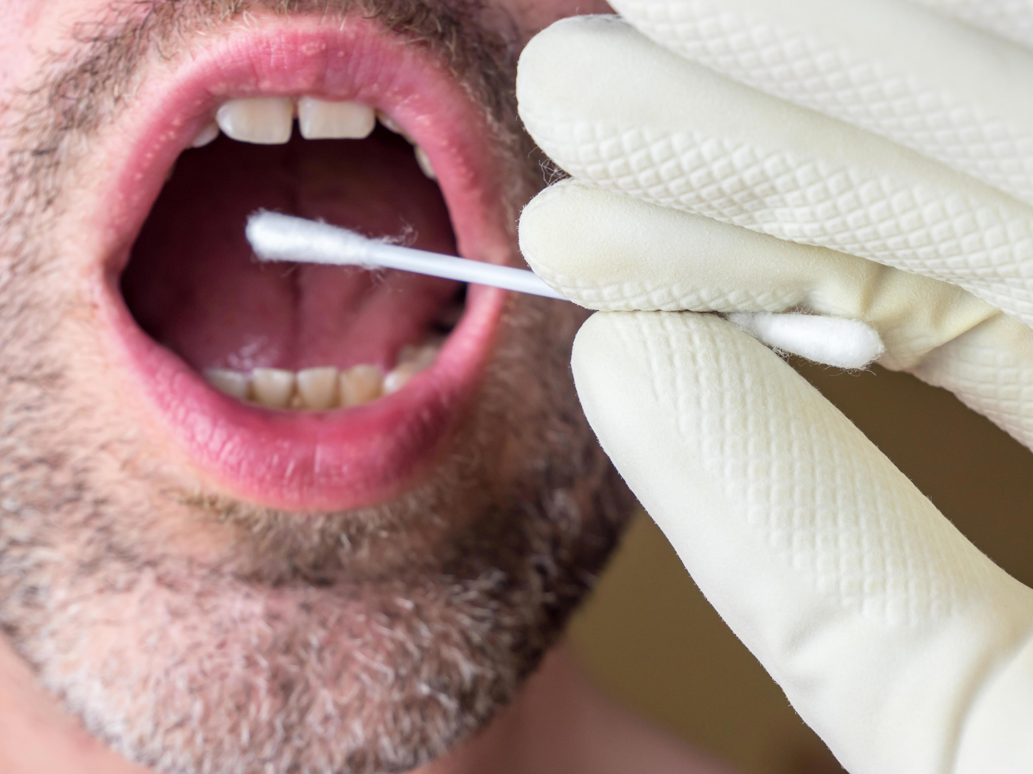 Cheek swabs to detect mutated genes ‘could become useful cancer ...
