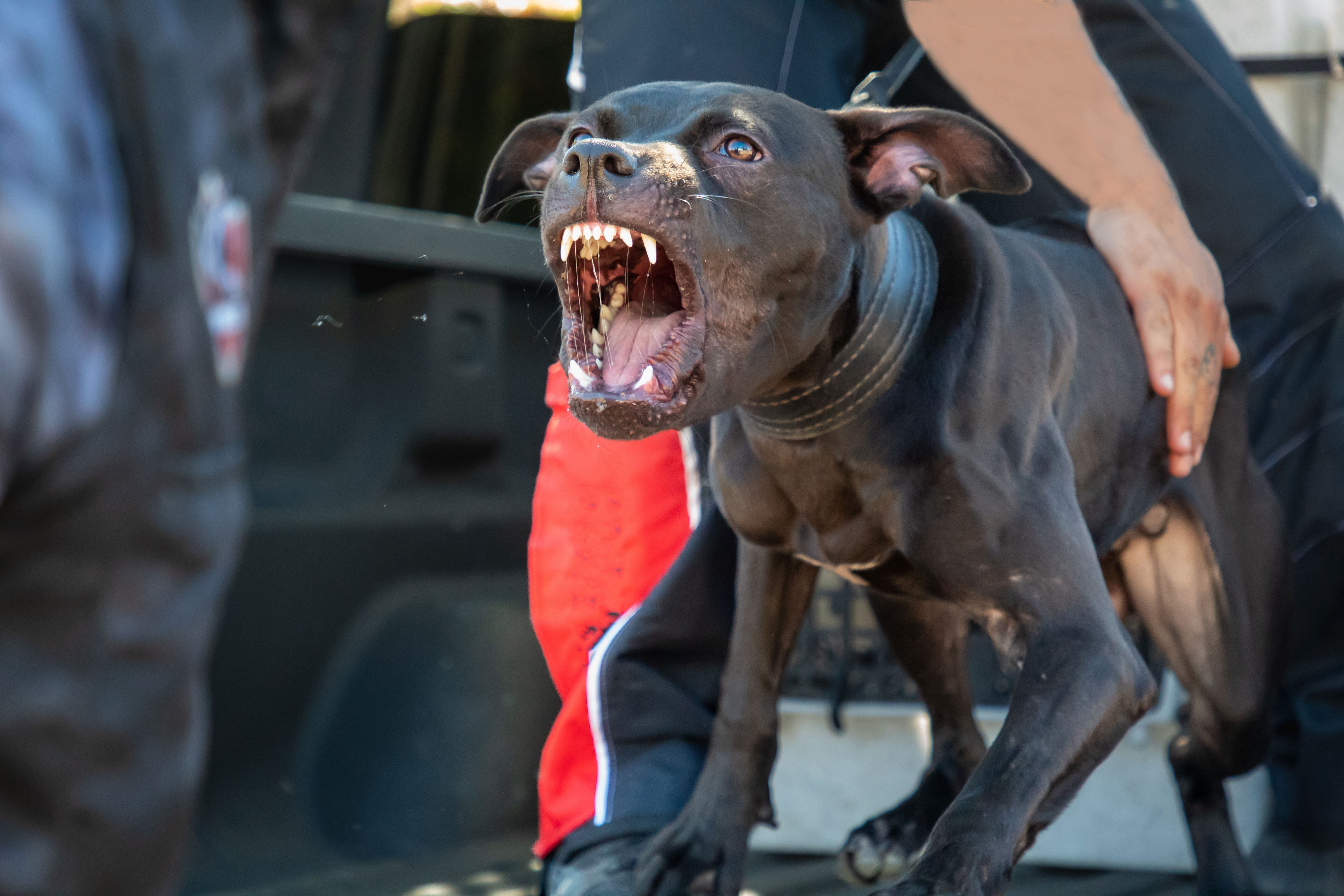 Woman Loses All Her Limbs After Pitbull Attack, and 12 Other Red Flags ...