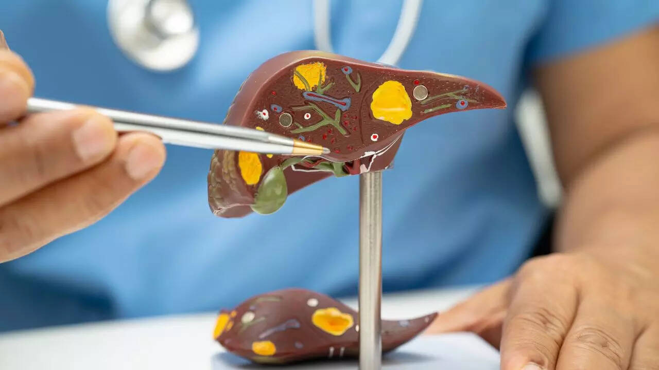 Dark spots on skin and its link with liver: 5 things to know