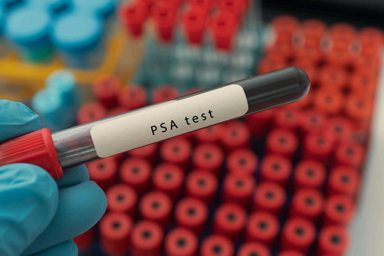 Widespread prostate cancer screening could soon become a reality