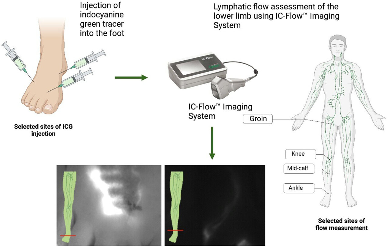 Faster lymph flow in the legs is linked to a better response to ...