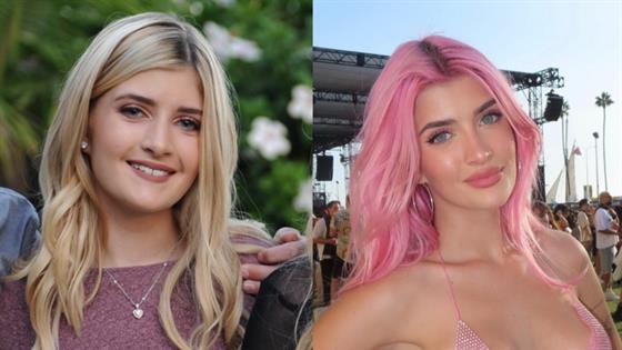 Sami Sheen Details Plastic Surgery Procedures She’s Had Done in Before ...