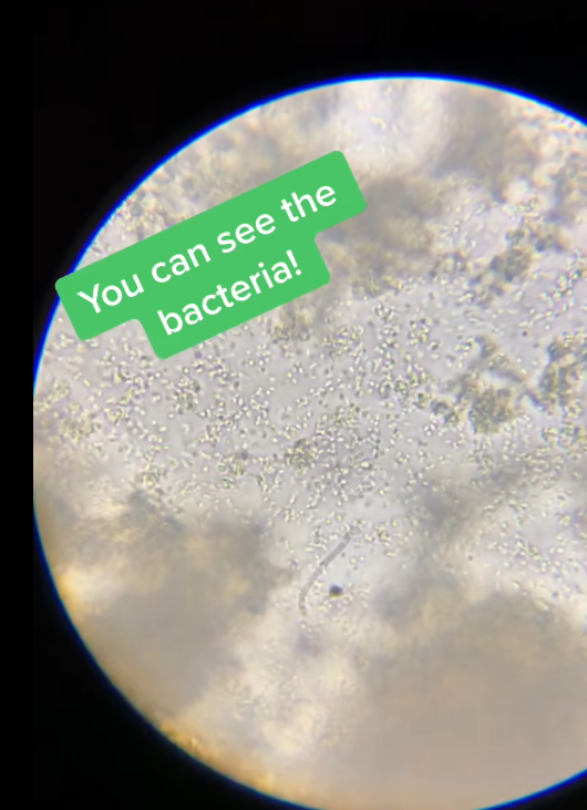 Yogurt Up Close Under the Microscope – You Have to See This!