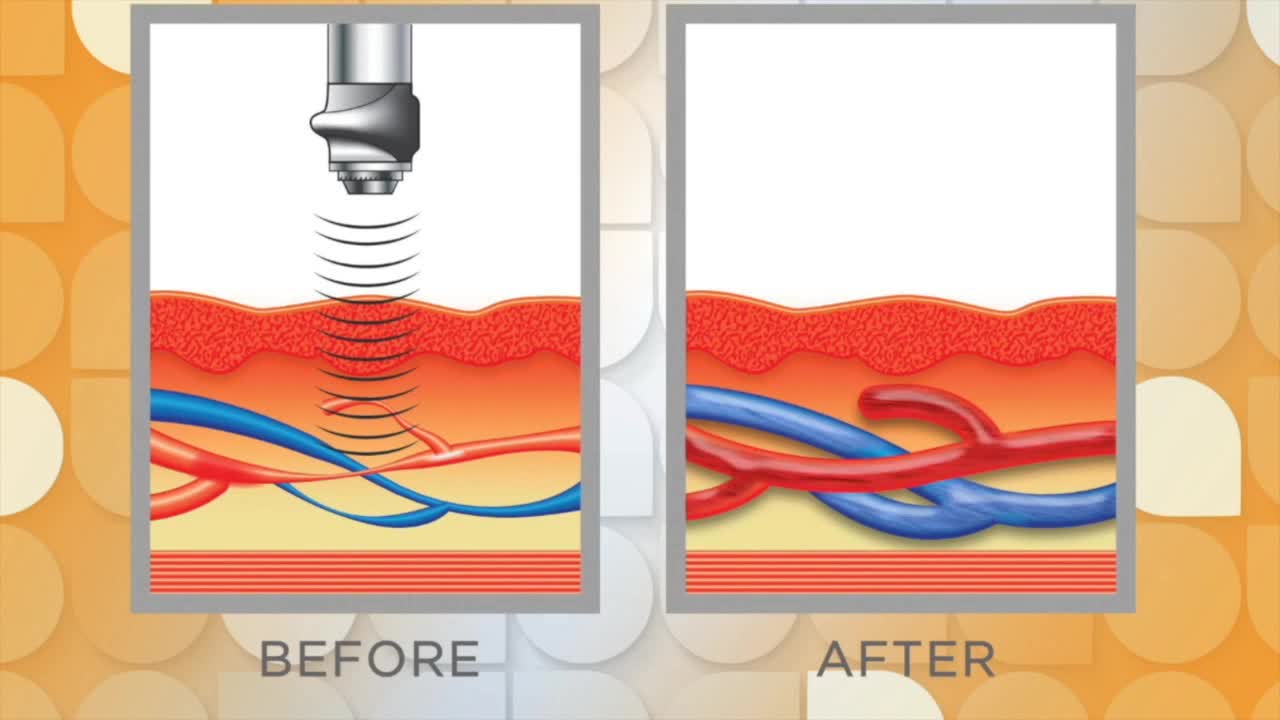 PG Men's Health | Morning Blend