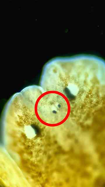 This Microscopic Worm Has Two Heads And Three Eyes!