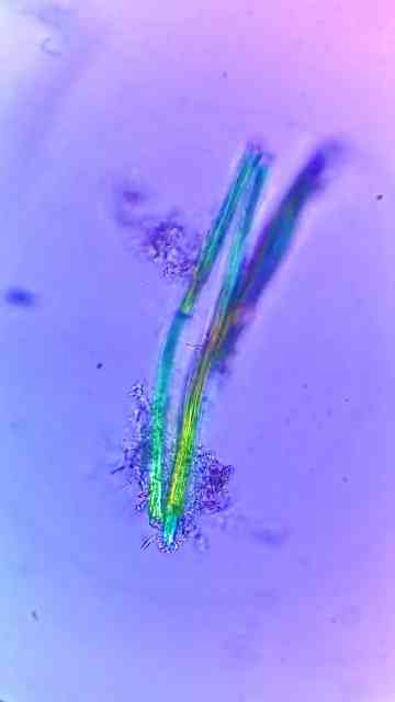 Fact Or Cap Do Worms Live Under Your Fingernails